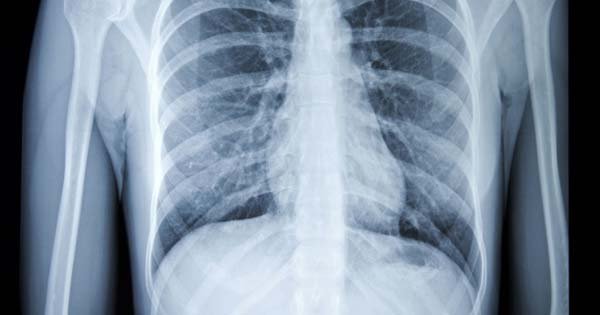 Todo lo que deben saber los pacientes sobre los rayos X